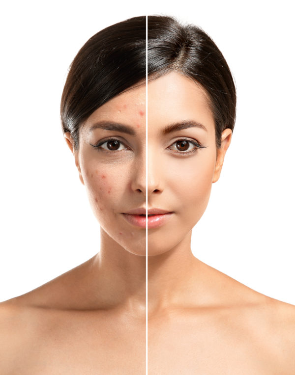 Most Common Skin Conditions